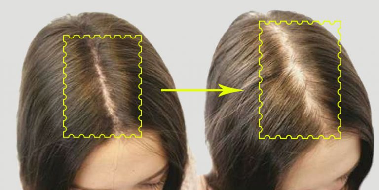 Your Hair Parting Might Be The Cause of Your Hair Breaking, Falling and ...